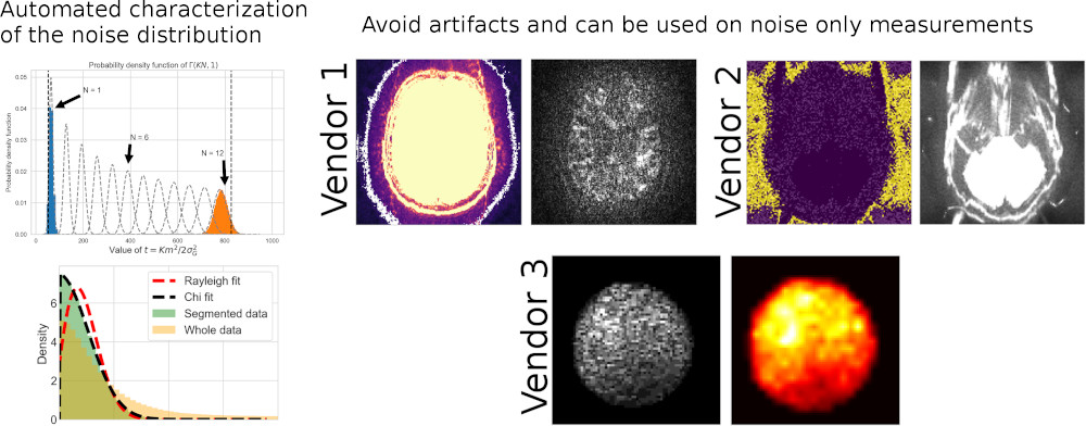 Automated characterization of noise distributions in diffusion MRI data ...